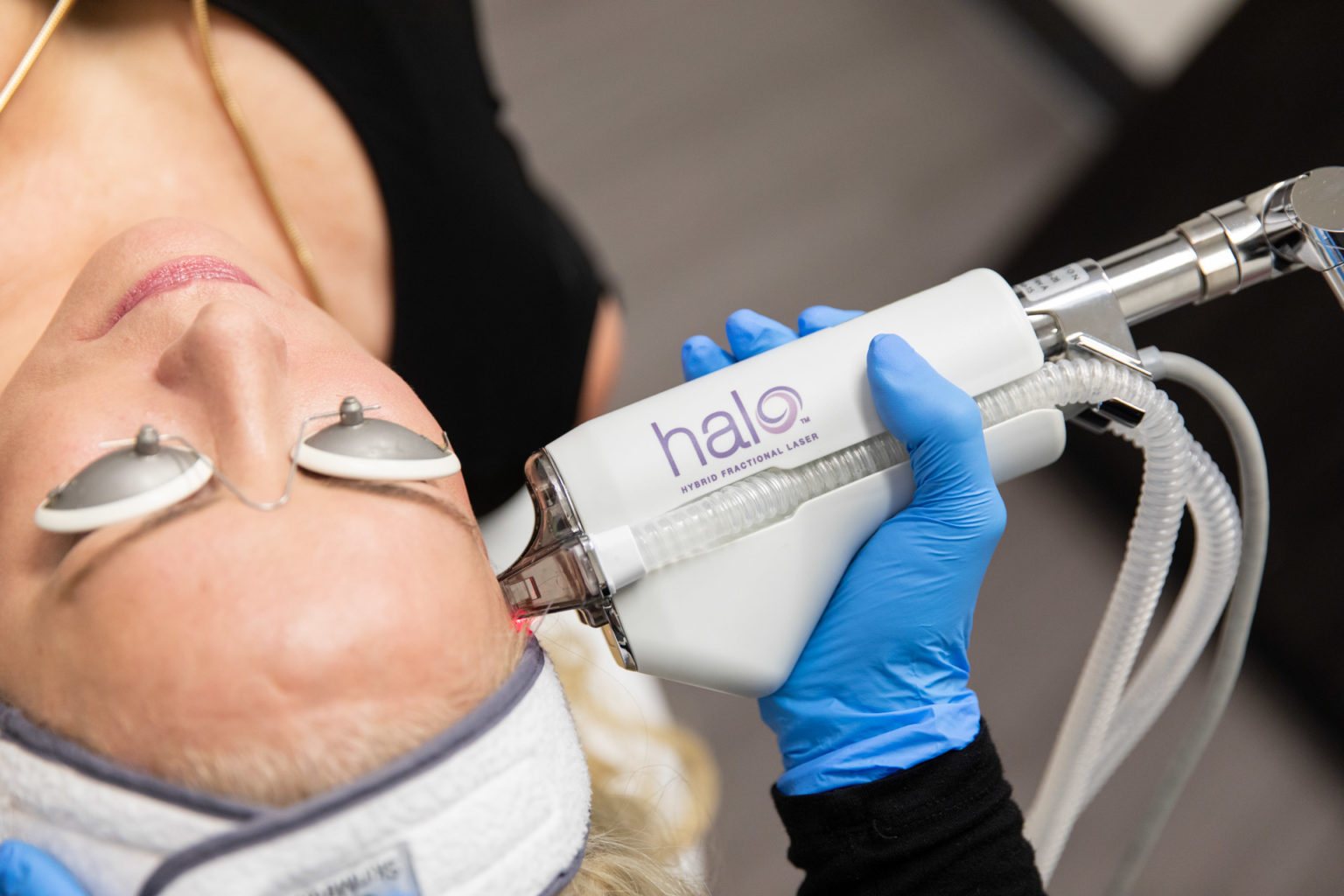 HALO® Laser Treatments - Sciton