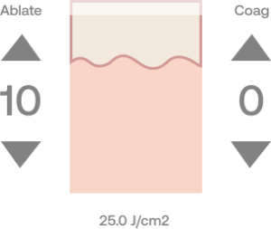 ProFractional® Laser Resurfacing by Sciton