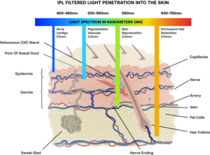 Forever BARE BBL® by Sciton