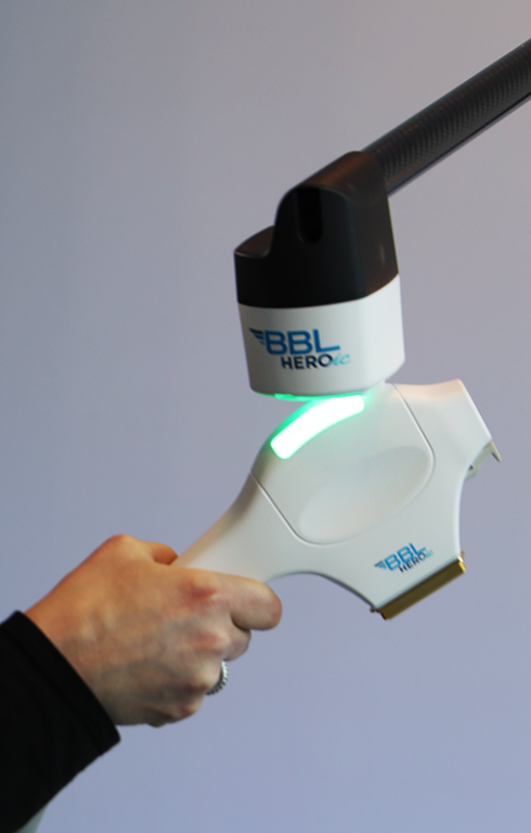 BBL® HEROic™️ by Sciton