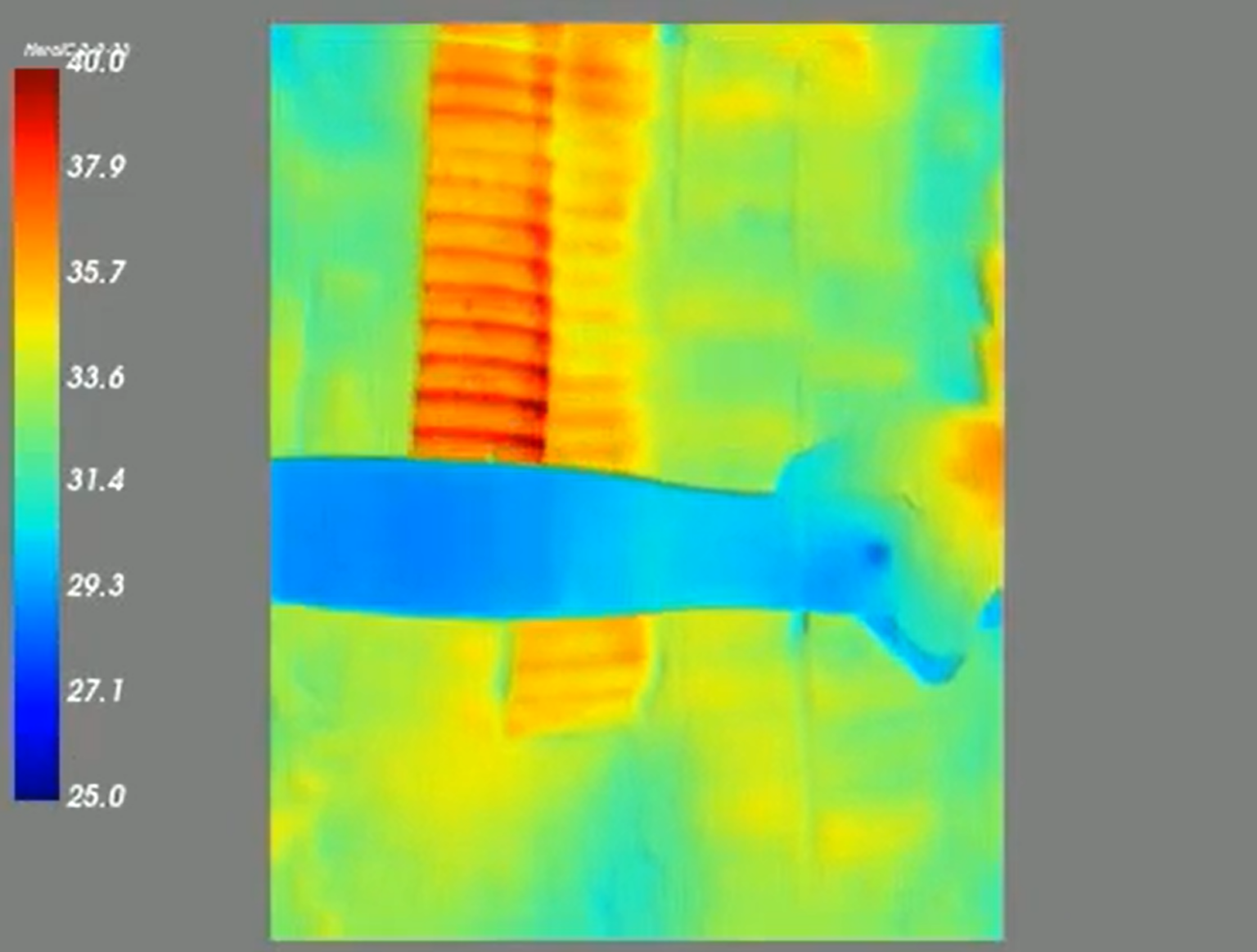 BBL® HEROic™️ by Sciton