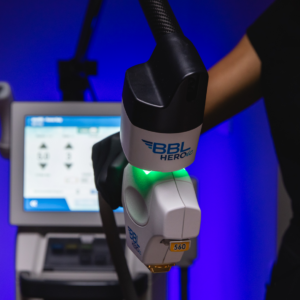 BBL® HEROic™️ by Sciton