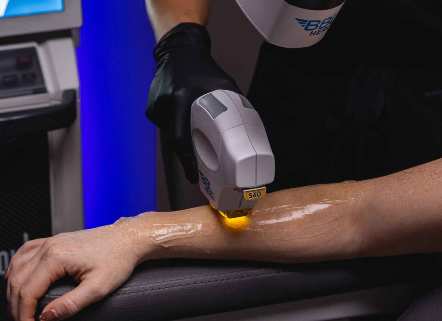 BBL® HEROic™️ - Sciton