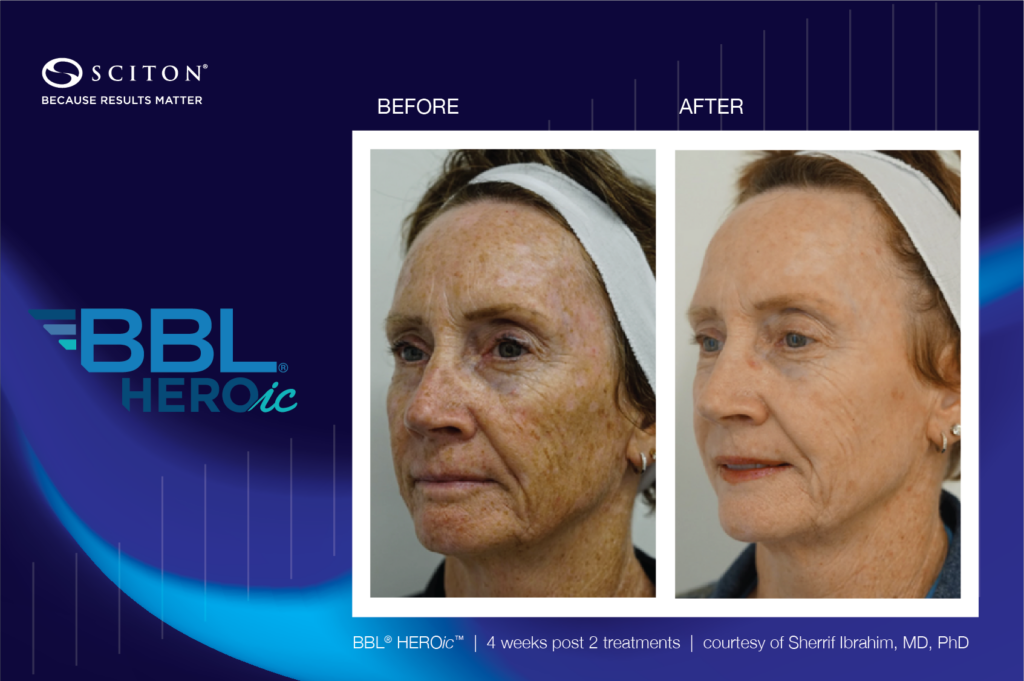 Welcome to Sciton Medical & Aesthetic Laser Technologies